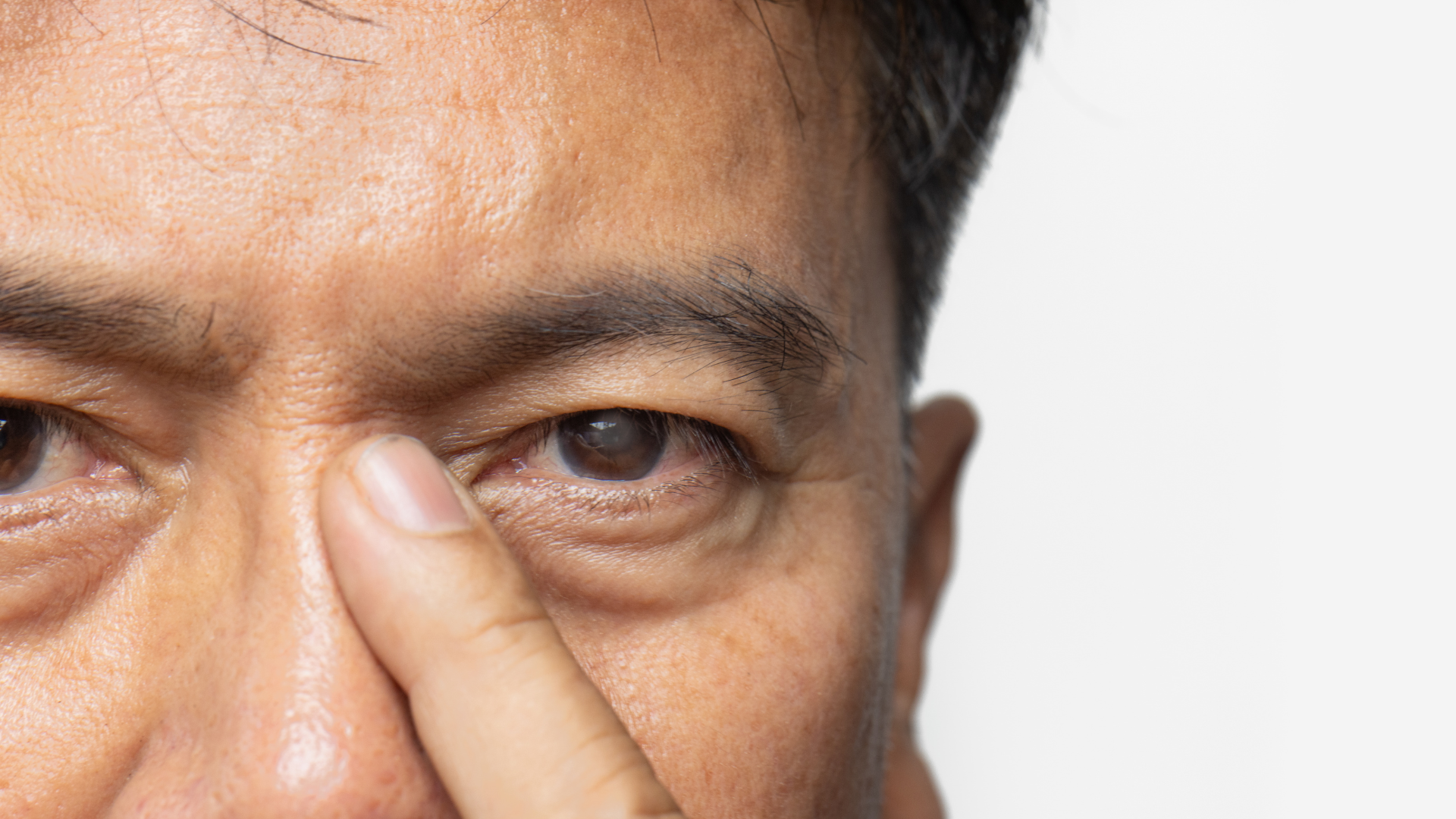 How to treat secondary cataract